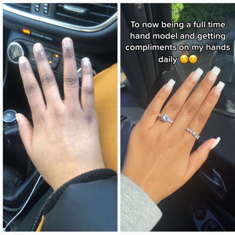 Kojic Acid Soap Before And After Photos Unedited Real Results