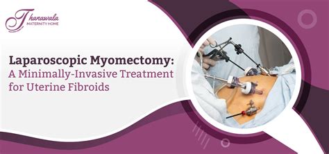 Laparoscopic Myomectomy A Minimally Invasive Treatment For Uterine Fibroids