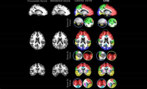 Masterfully Segment Classify Detect Diseases And Enhance Medical Image By Fahadkhalid92 Fiverr