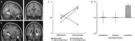 The Hippocampus Supports Encoding Of Between Domain Associations Within
