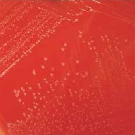 Pdf Isolation Characterization Antibiogram And Pathology Of Pasteurella Multocida Isolated