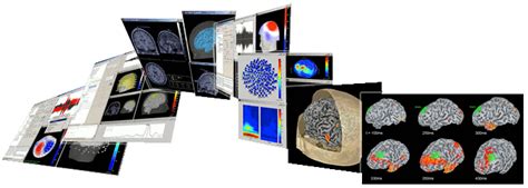 brainstorm biomedical imaging group