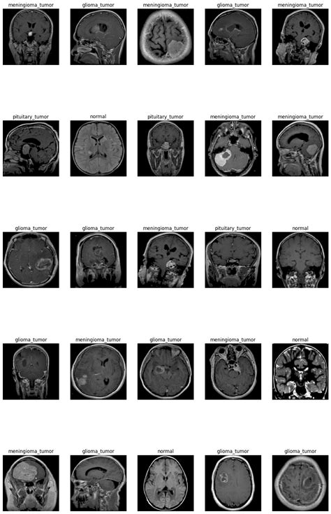 Github Mojtabazarreh Brain Tumors Classification Brain Image Classification With Cnn
