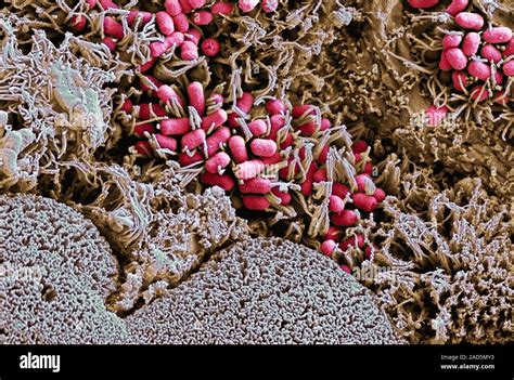 Ehec Bacteria On Small Intestine Tissue Coloured Scanning Electron Micrograph Sem Of An