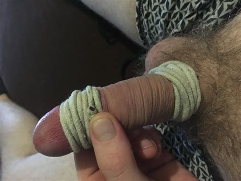 Hairy Limp Cock Bondage Bound Cock And Cockhead 33 Pics Xhamster