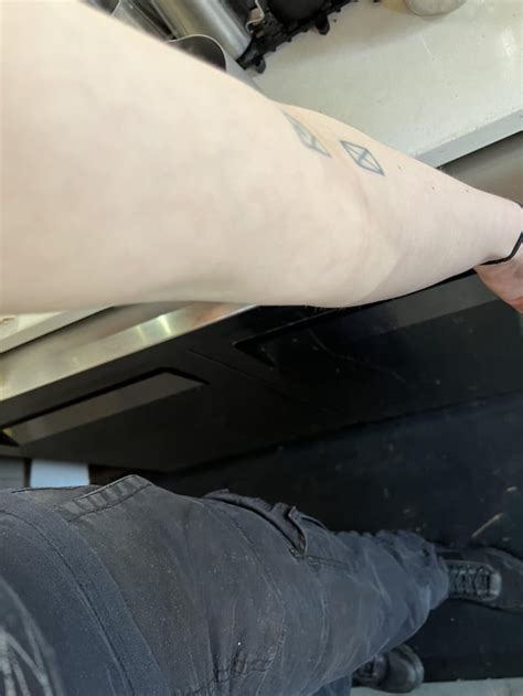 indentation in skin at where my nexplanon is inserted more info below