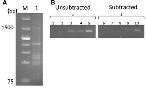 Cdnas Subtraction Products After Second Nested Pcr Amplification Of