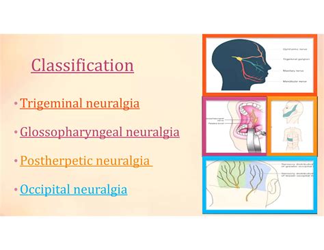 Neuralgia Ppt Pdf
