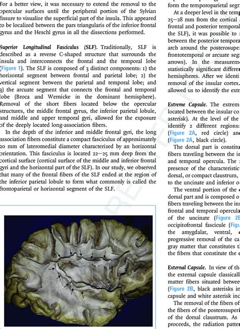 The Superior Longitudinal Fasciculus Slf Is Composed By A Horizontal