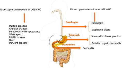Digestive Endoscopy Meaning At Rafael Gilliam Blog