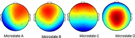 Eeg Microstates Identified Phonological Processing Microstate A