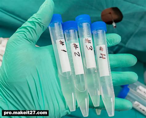 Csf 의학용어 Ng 의학용어 Als 의학용어 Pro27