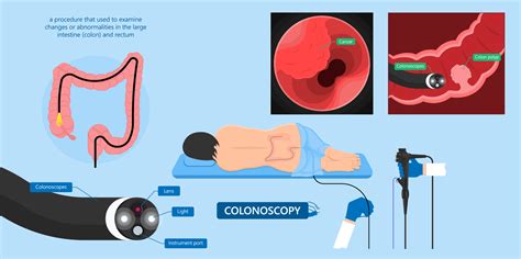 Colorectal Cancer Initial Assessment Mims Philippines