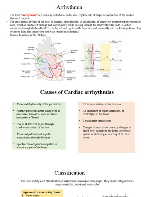 Arythmia Pdf Heart Heart Rate