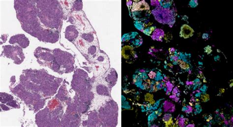 Mount Sinai Doctors Mount Sinai New York