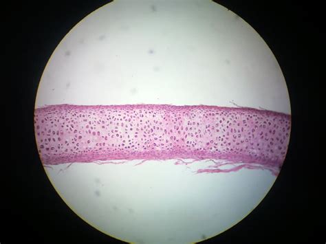Hyaline Cartilage Perichondrium