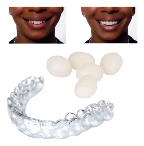 Kit Diente Provisorio Postizo Reparador Placa Descanso Mercadolibre