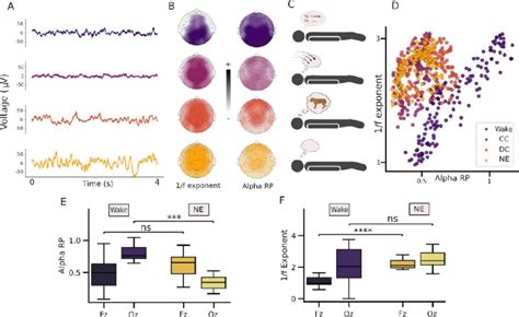 Eeg Activity Across Arousal States A Eeg Signal Traces For Wake Download Scientific
