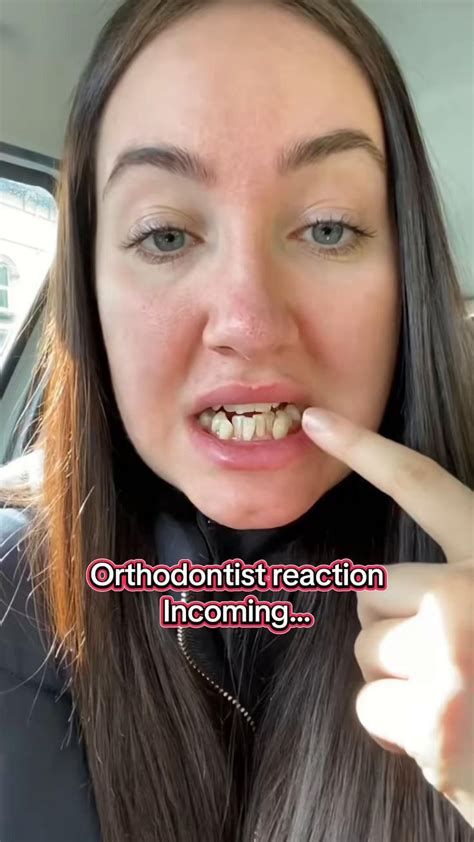 Adult Braces Can Be A Process And Usually Its A Pretty Involved