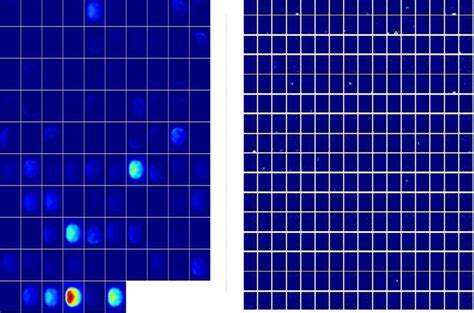 An Fmri Scan For The Sz Patient Left Activate The Data As An Input