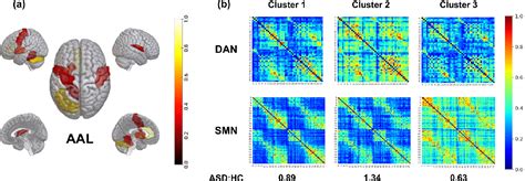 Spatio Temporal Attention In Multi Granular Brain Chronnectomes For Detection Of Autism Spectrum