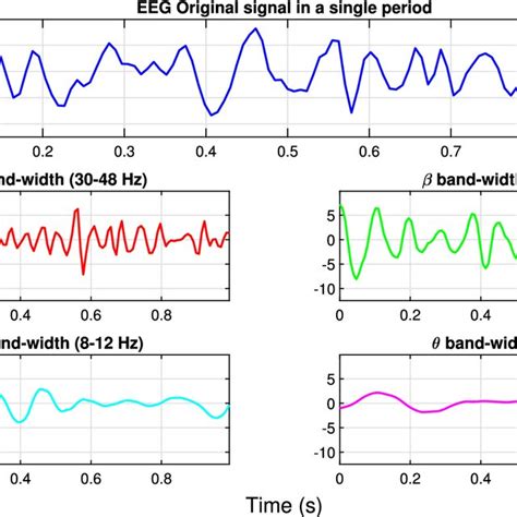 Single Period Of Frequency Bands From One EEG Channel Download Scientific Diagram