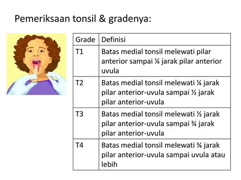 Tonsilitis Oleh Dr Irma Susanti Ppt Download