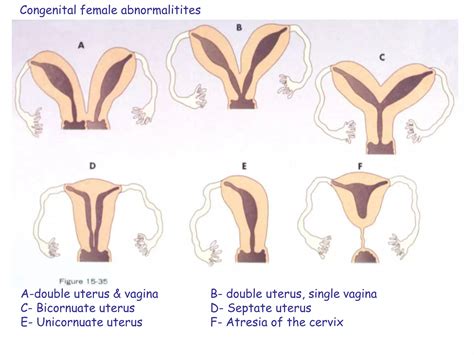 Urogenital Development And Sex Determinationppt