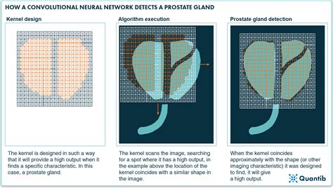 Deep Learning Radiology The Secret Of Convolutional Neural Networks