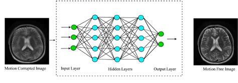 Figure 2 From A Literature Review On Fetus Brain Motion Correction In Mri Semantic Scholar