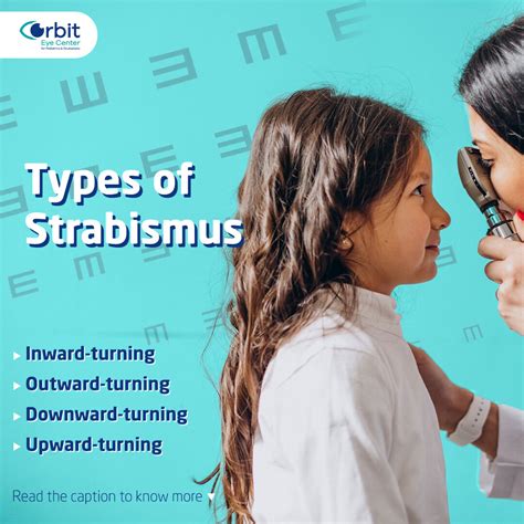 Didyouknow That There Are Multiple Types Of Strabismus Orbit Eye Center