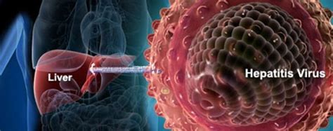 Natural Cure For Hepatitis B Plant To Cure Hepatitis B
