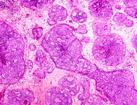 New Nanofabrication Technique Can Speed Up Dna Sequencing Nanoapps