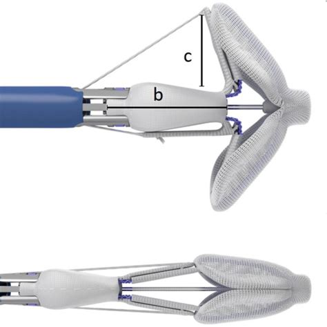 Design Of The Edwards Pascal Clasp Iid Iif Pivotal Clinical Trial Download Scientific Diagram