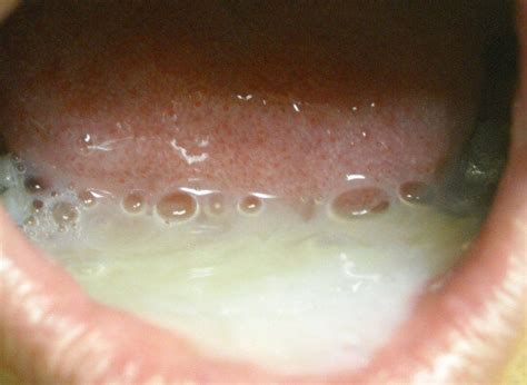 Knm Closeup Cum Pin 46709823