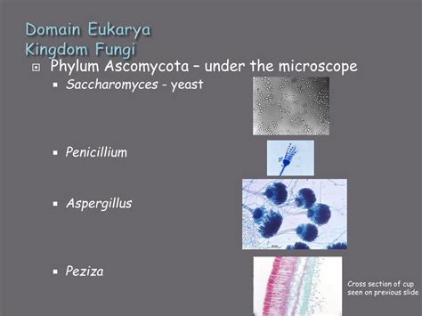 Phylum Ascomycota Microscope