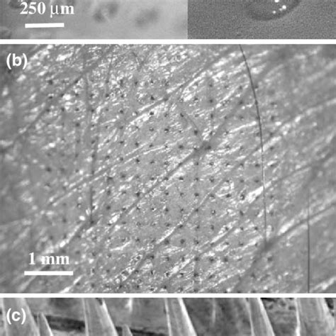 Fabrication Of A Microneedle Master Structure A Definition Of