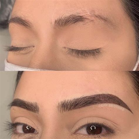 When And Why Do Microblading Scars Form What To Do