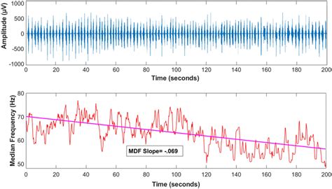 Emg Parameters Top Sample Of Electromyography Activity And Bottom