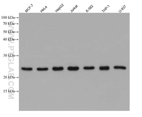 Multi Rab™ Hrp Goat Anti Rabbit Recombinant Secondary Antibody H L Secondary Antibody Rgar001
