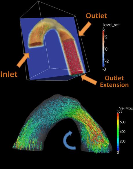 a our computational setup the lagrangian aortic mesh is embedded in