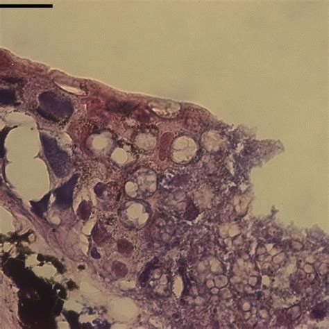 Chytrid Fungus Bs Taxa Genomics