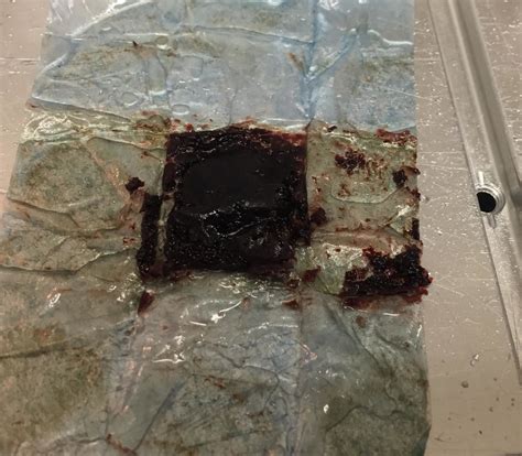 Cytology Specimens For Theragnostic Cancer Treatment Eric Hanson