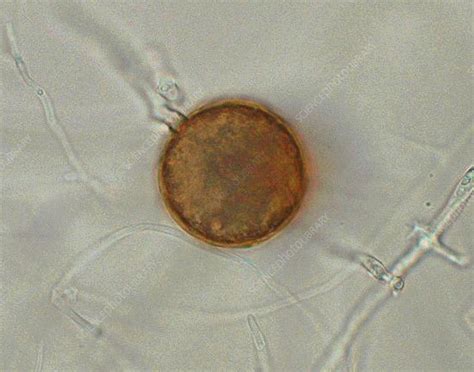 Phytophthora Ramorum Pathogenic Spore Light Micrograph Stock Image