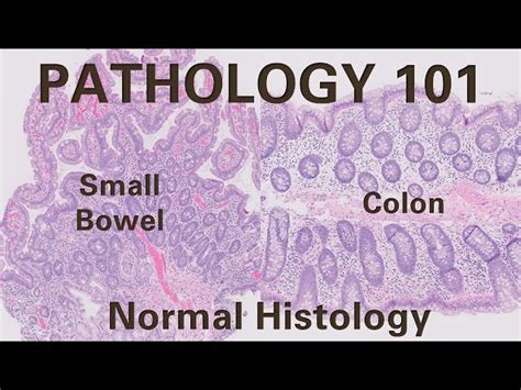 Normal Duodenum Histology