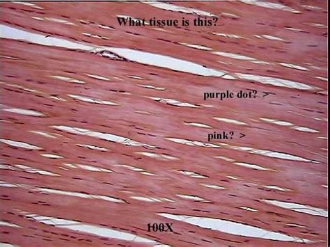 Slides Dense Regular Ct Tendon Diagram Quizlet