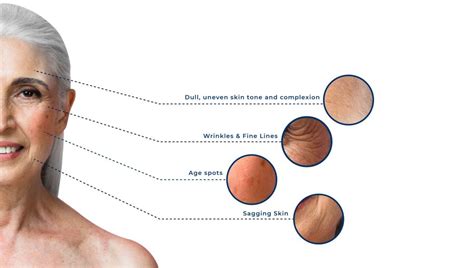 Aging Skin Ko Skin Specialist