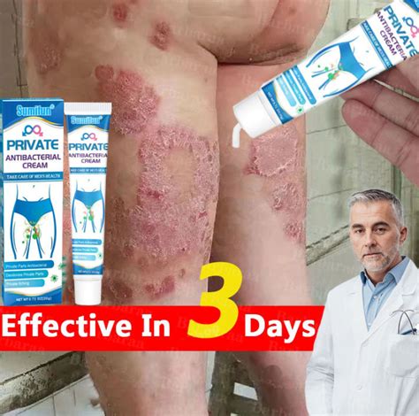 Uninice Ointment For Itchy Skin And Allergy 20g For The Treatment Of