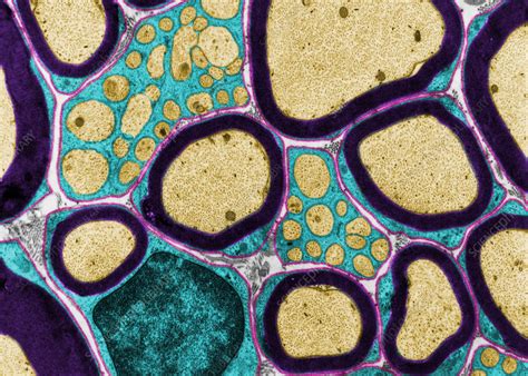 Unmyelinated And Myelinated Nerve Fibres Tem Stock Image C060 4573 Science Photo Library