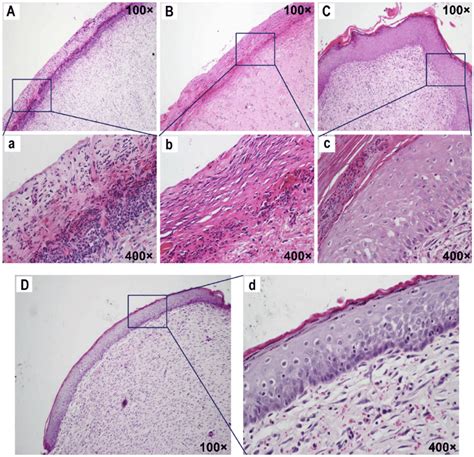 Ca Cd Cur Treated Wounds Showed Optimized Epithelialization Notes